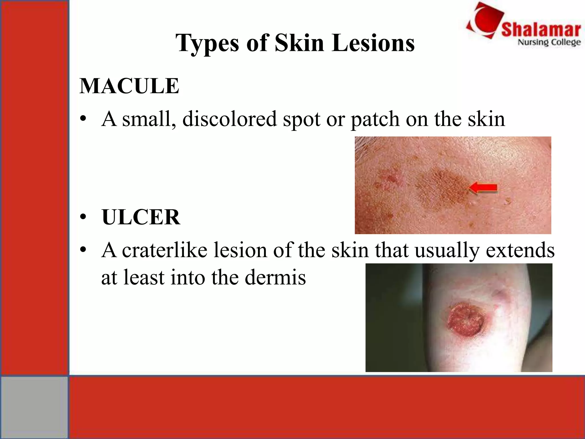 Assessment of Skin, Hairs & Nails. | PPTX
