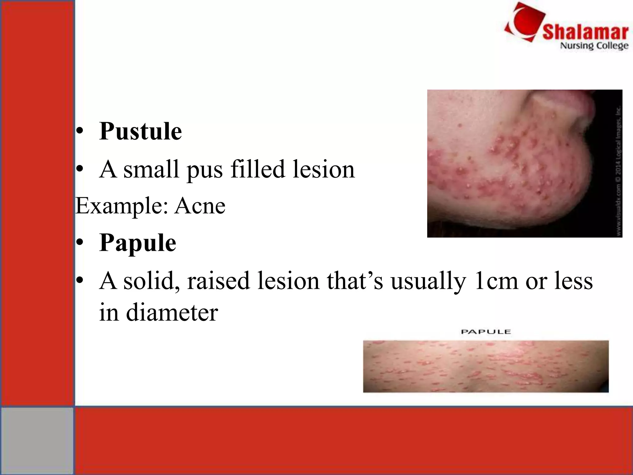 Assessment of Skin, Hairs & Nails. | PPTX