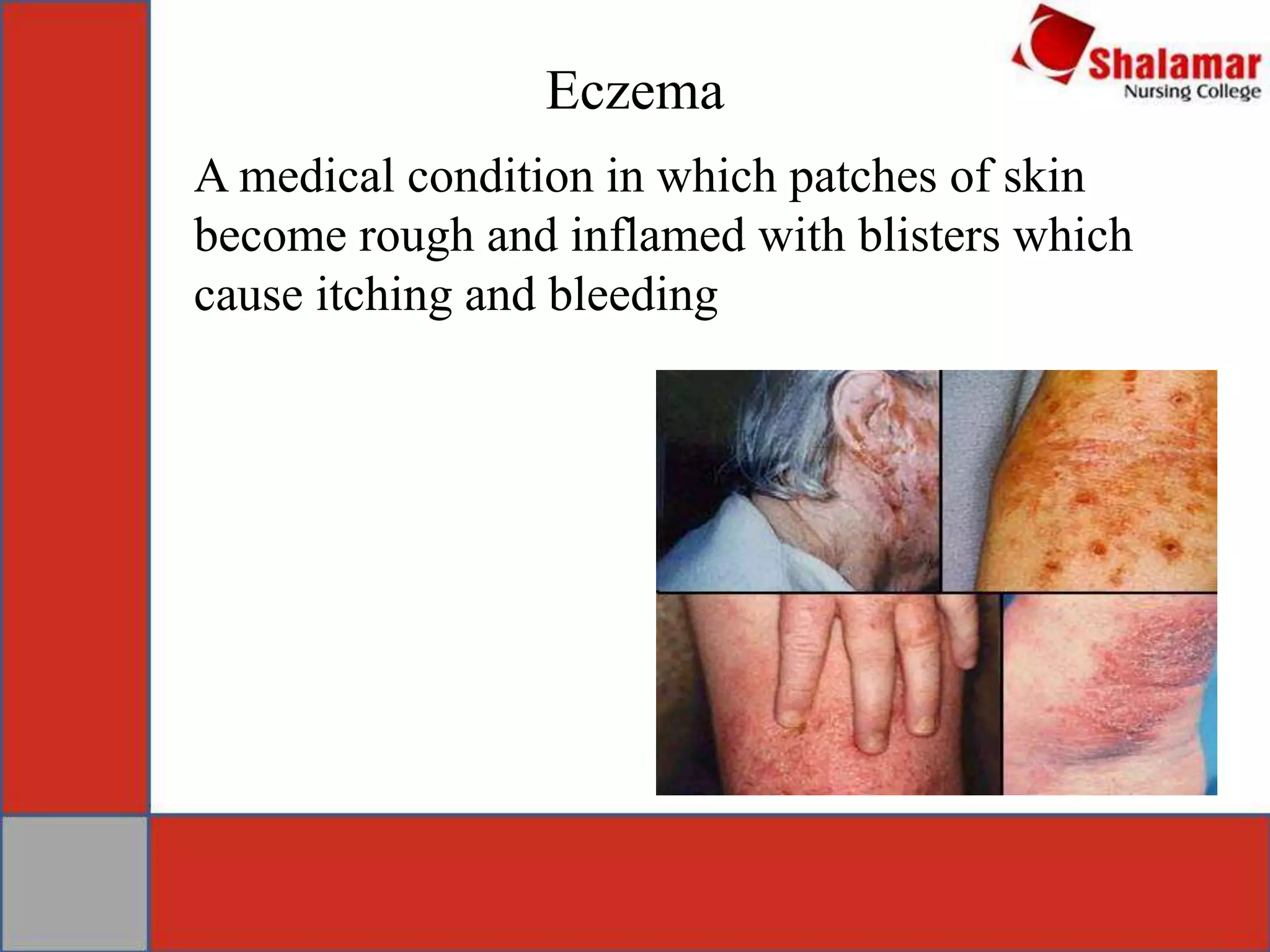 Assessment of Skin, Hairs & Nails. | PPTX
