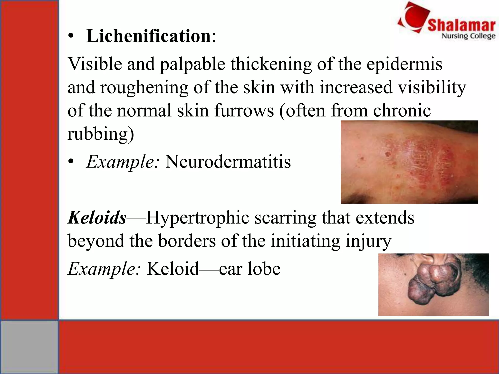 Assessment of Skin, Hairs & Nails. | PPTX