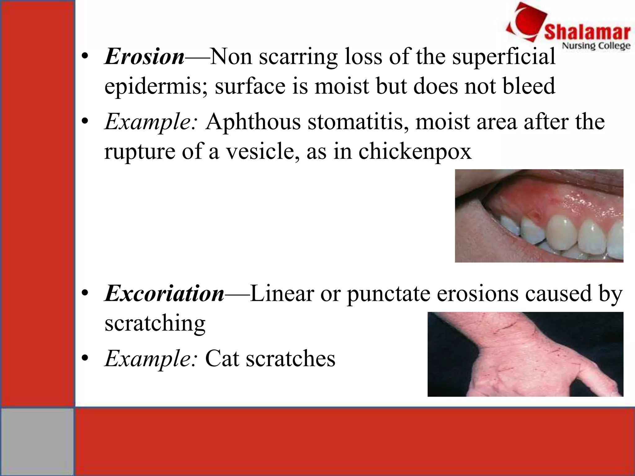 Assessment of Skin, Hairs & Nails. | PPTX
