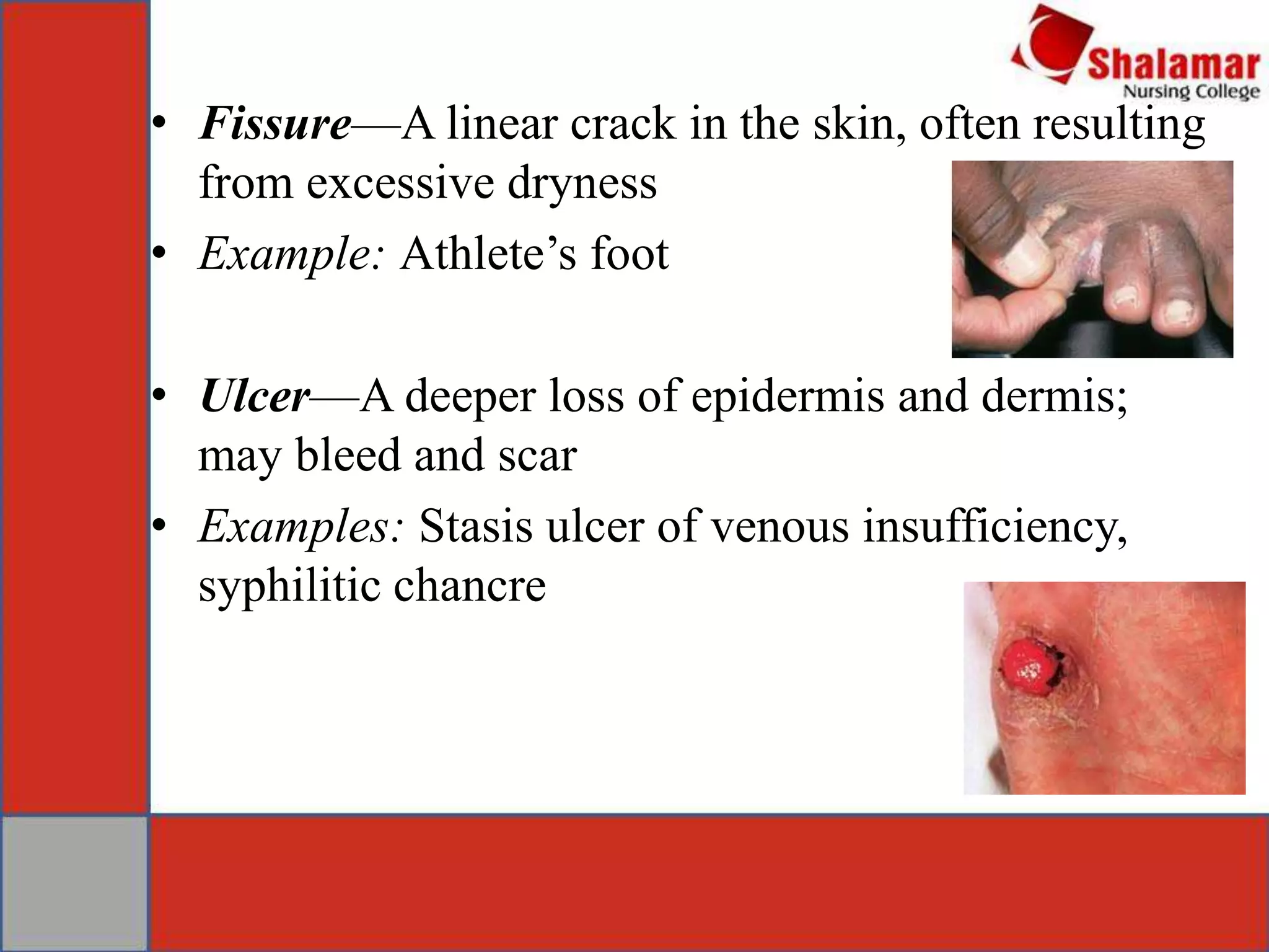 Assessment of Skin, Hairs & Nails. | PPTX