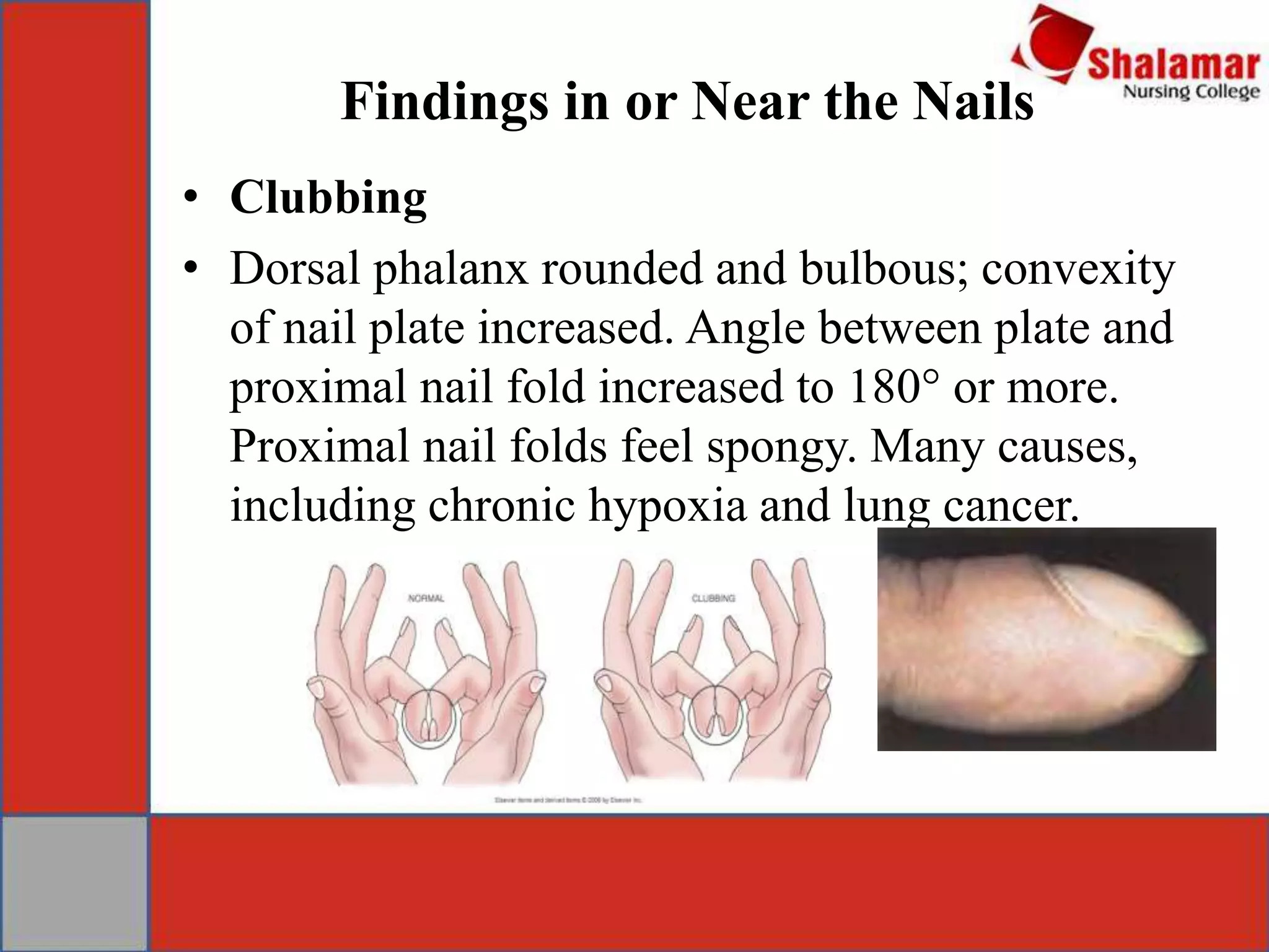 Assessment of Skin, Hairs & Nails. | PPTX