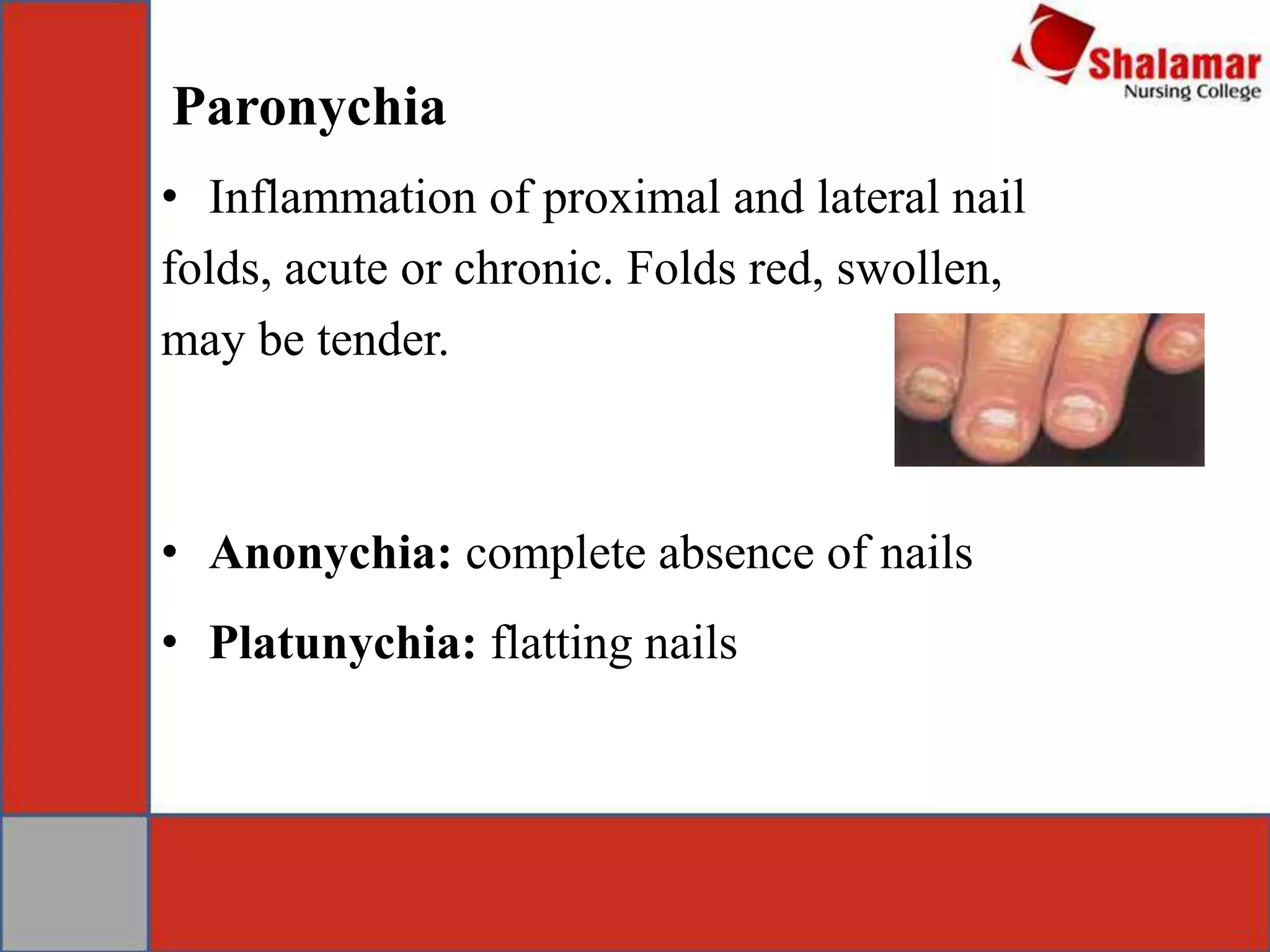Assessment of Skin, Hairs & Nails. | PPTX