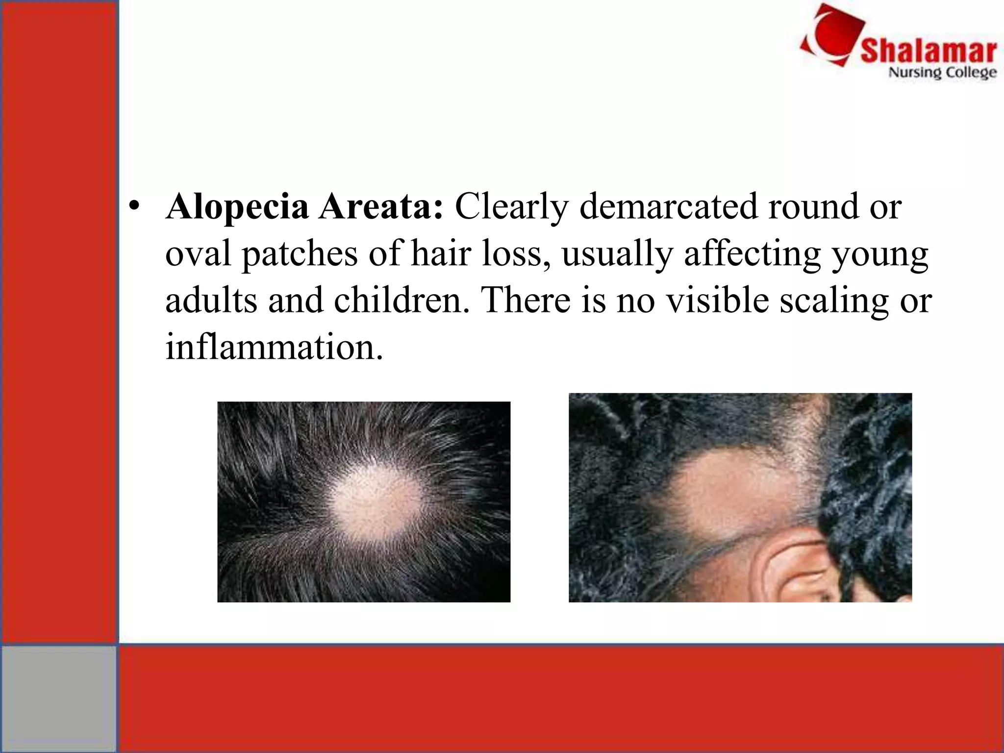 Assessment of Skin, Hairs & Nails. | PPTX