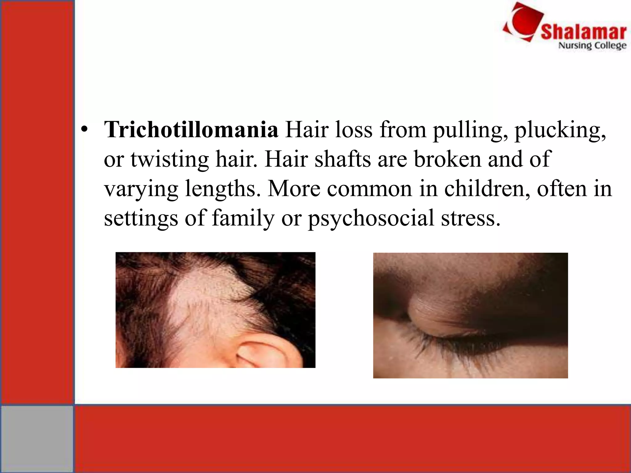 Assessment of Skin, Hairs & Nails. | PPTX