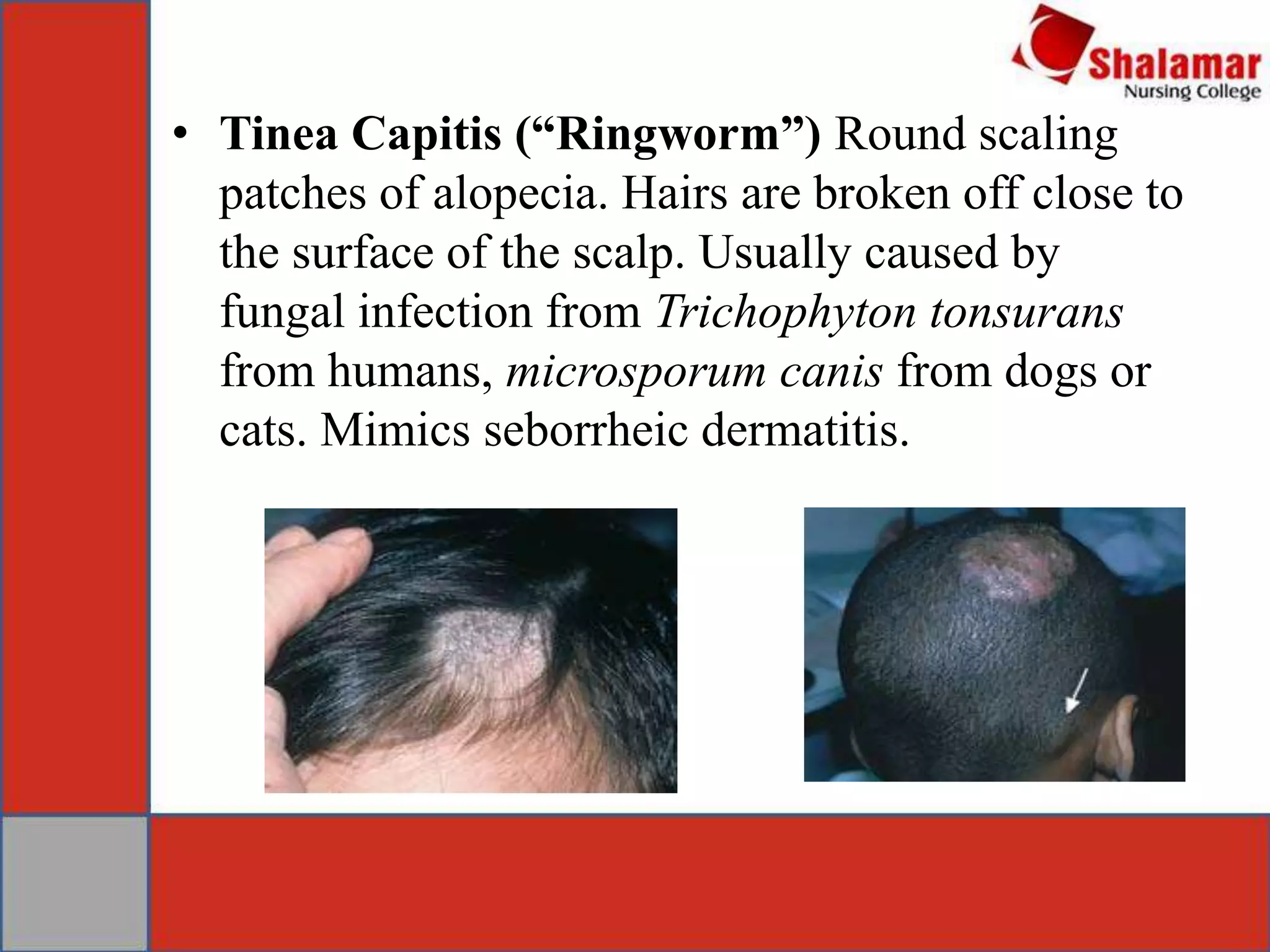 Assessment of Skin, Hairs & Nails. | PPTX