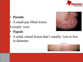 Assessment of Skin, Hairs & Nails. | PPTX