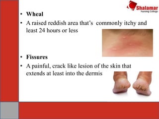 Assessment of Skin, Hairs & Nails. | PPTX