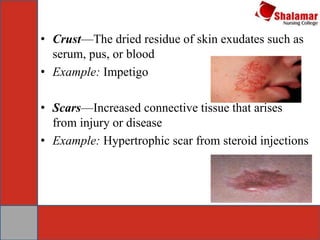 Assessment of Skin, Hairs & Nails. | PPTX