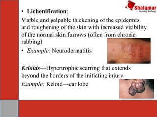 Assessment of Skin, Hairs & Nails. | PPTX