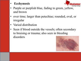 Assessment of Skin, Hairs & Nails. | PPTX