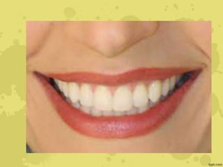 Assessment of smile | PPTX