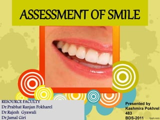 Assessment of smile | PPTX