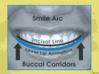 Assessment of smile | PPTX