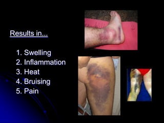 Assessment of Sports Injuries - 1.pdf