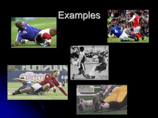 Assessment of Sports Injuries - 1.pdf
