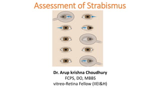 Assessment of strabismus | PDF