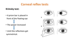 Assessment of strabismus | PPT