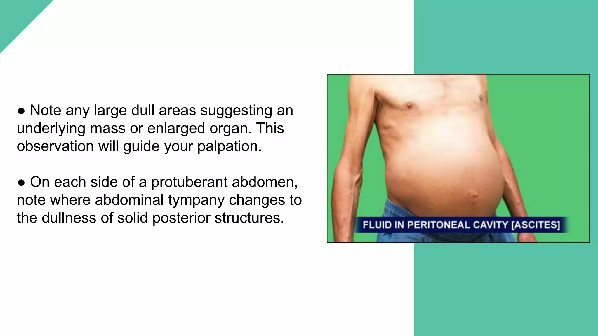 Assessment of the abdomen | PPTX