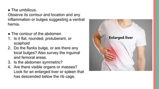 Assessment of the abdomen | PPTX