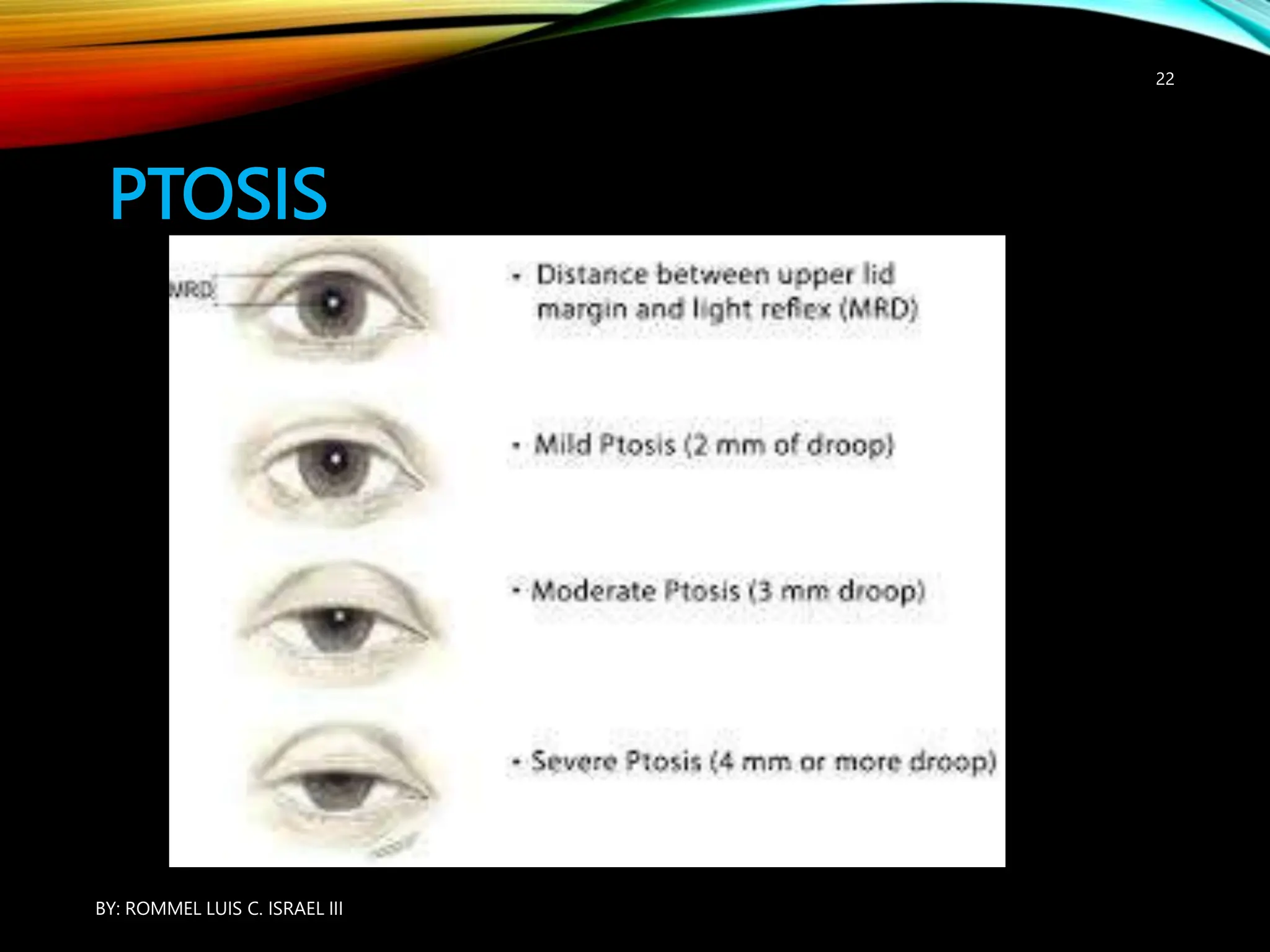 ASSESSMENT OF THE EYE (1)-Health Assessment.ppt