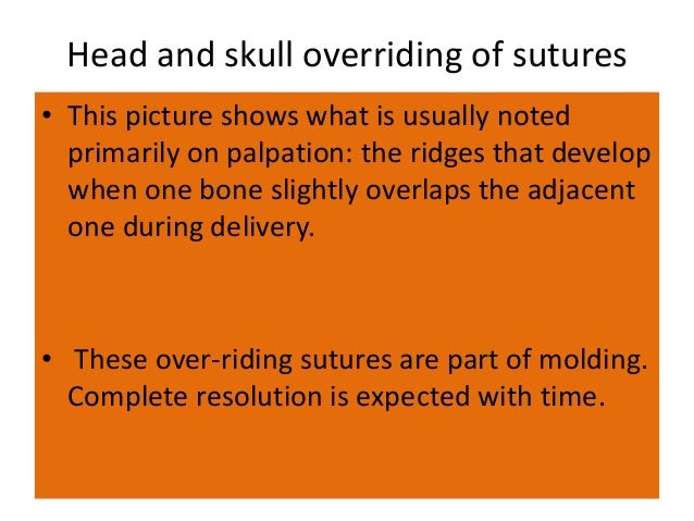 Assessment of the new born