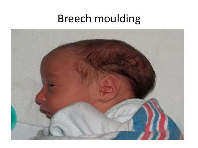 Assessment of the new born