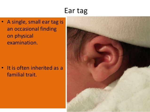 Assessment of the new born