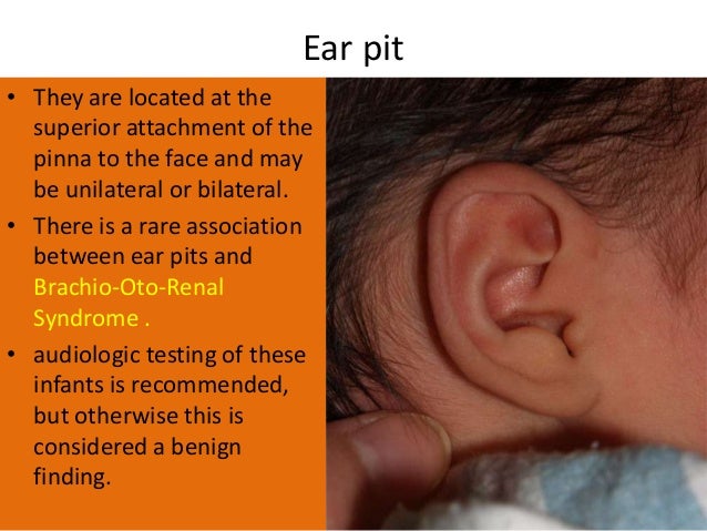 Assessment of the new born
