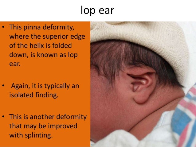 Assessment of the new born