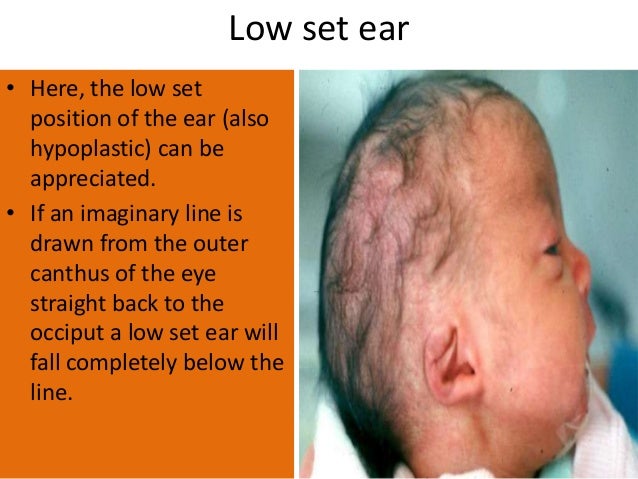 Assessment of the new born