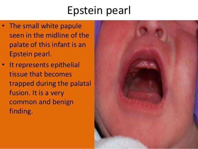 Assessment of the new born