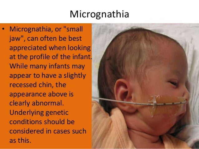 Assessment of the new born