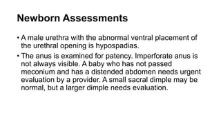 ASSESSMENT OF THE NEWBORN CHILDREN POWERPOINT.pptx