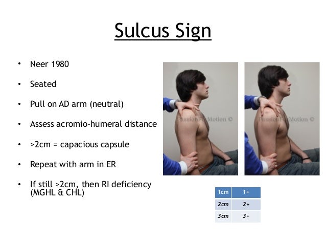 Assessment of the unstable shoulder