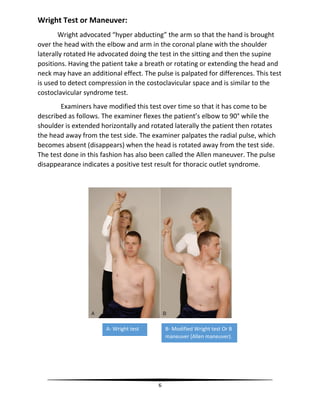 Assessment of thoracic outlet syndrome | PDF