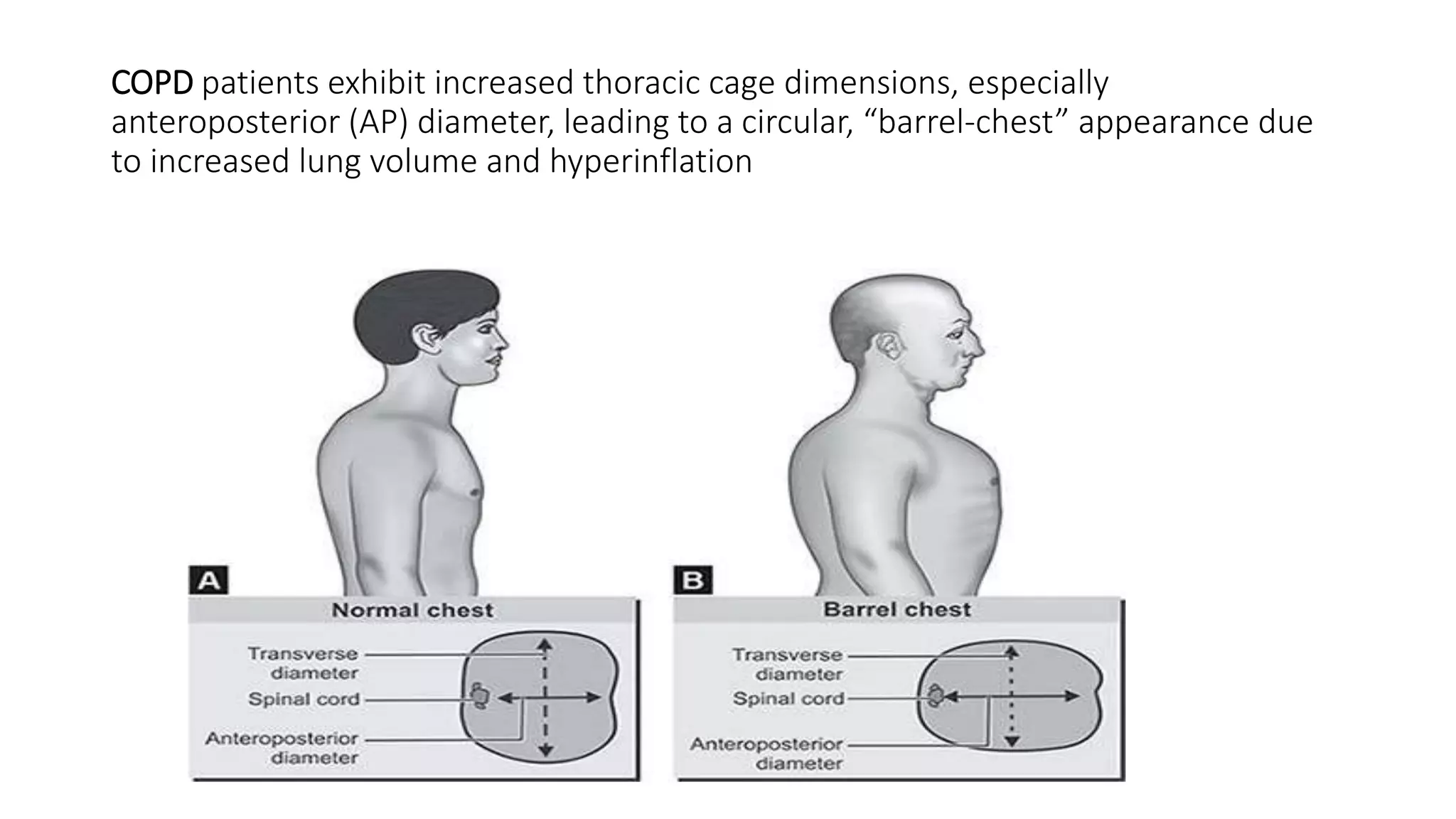 assessment of thorax.pptx