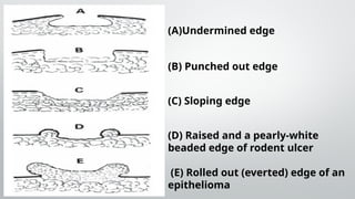 ASSESSMENT OF ULCER - in Clinical Surgery.pptx