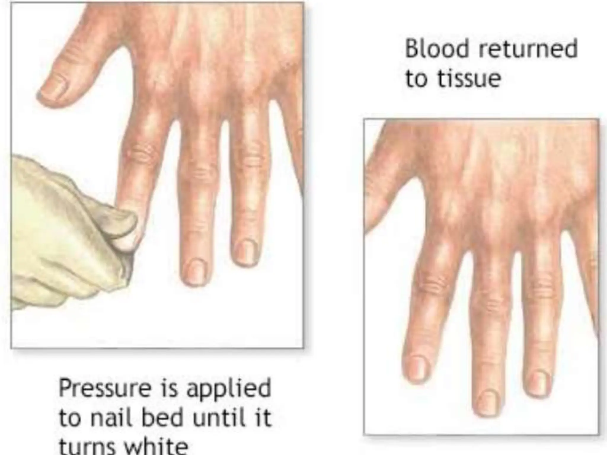 Assessment of peripheral vascular system | PPTX