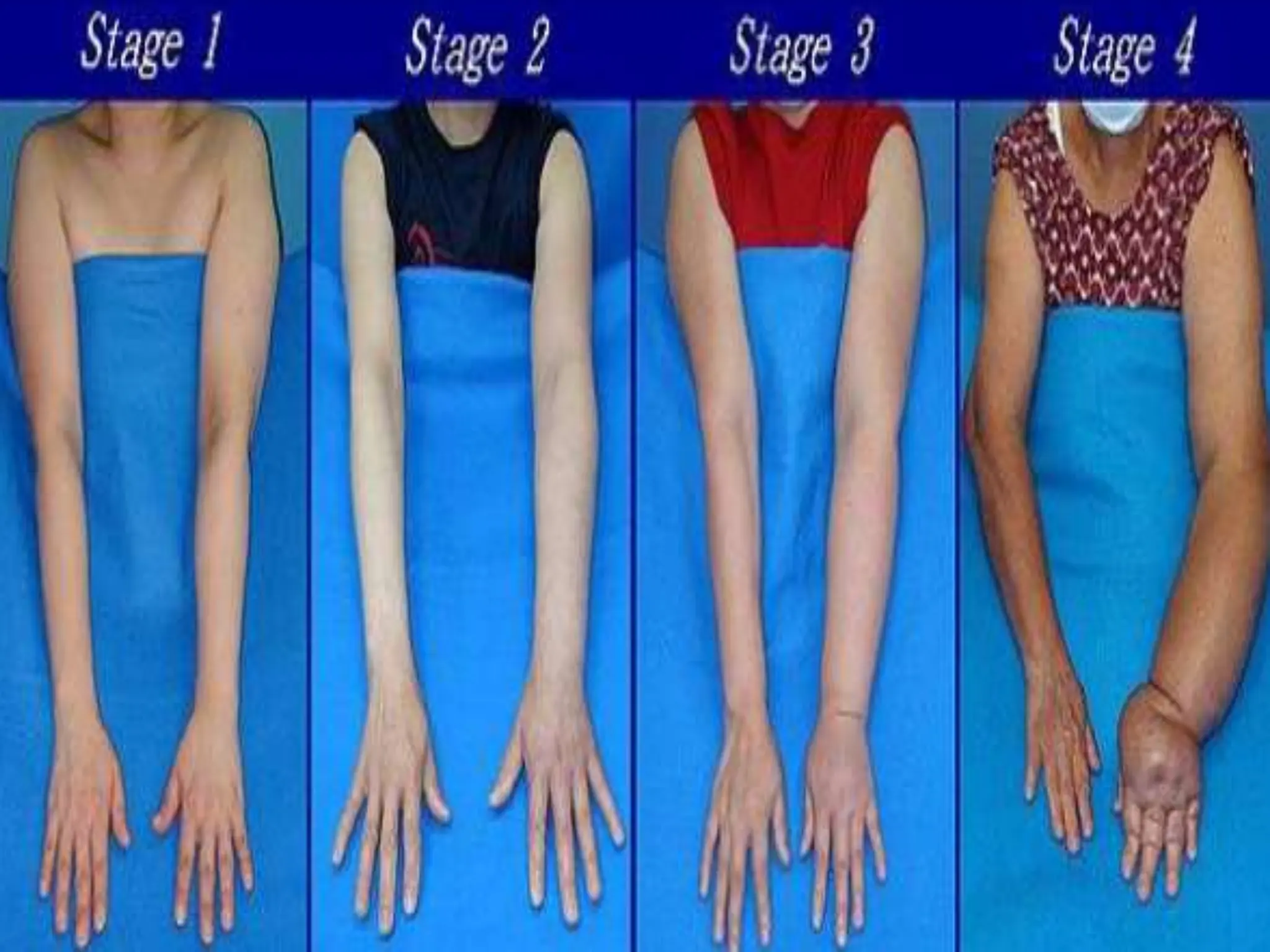 Assessment of peripheral vascular system | PPTX