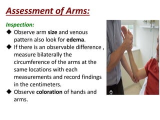 Assessment of peripheral vascular system | PPTX