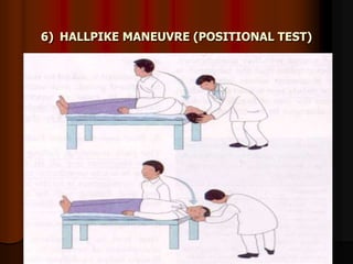Assessment of vestibular function test | PPT