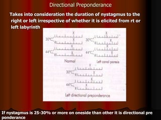 Assessment of vestibular function test | PPT