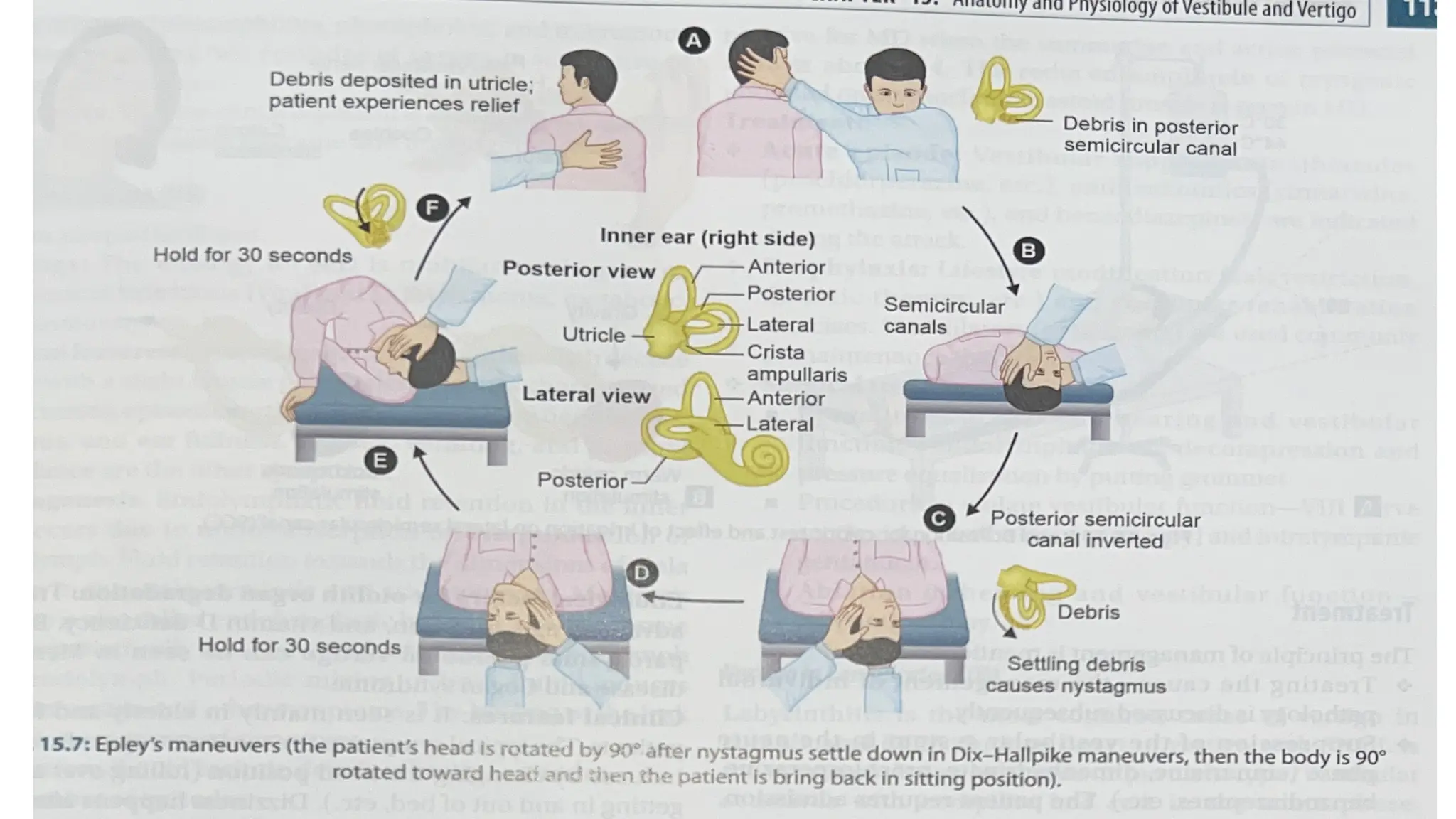 Assessment of Vestibular system UG MBBS.pptx