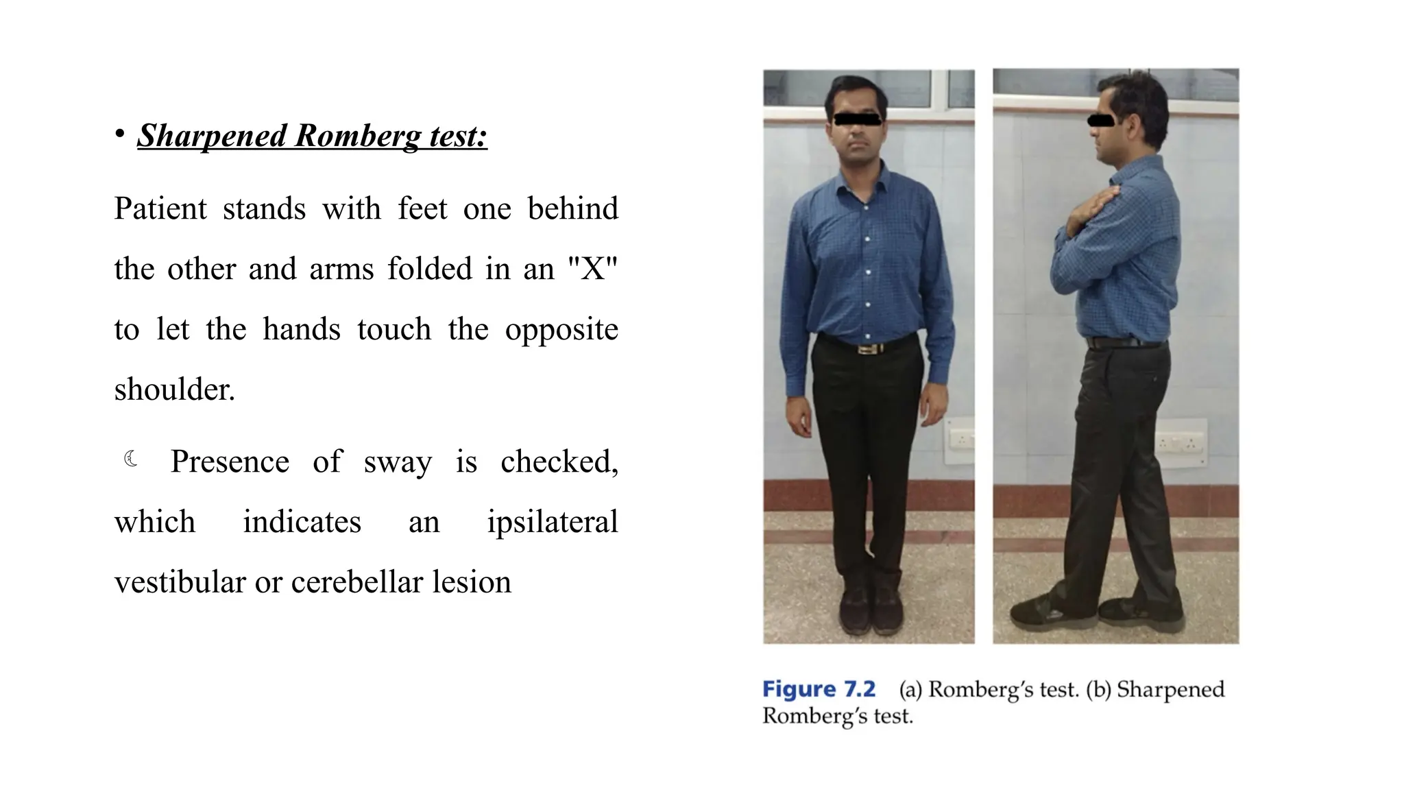 Assessment of Vestibular system UG MBBS.pptx