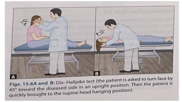Assessment of Vestibular system UG MBBS.pptx