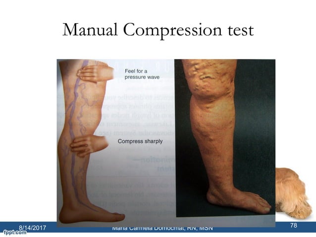 Assessment peripheral blood vessel
