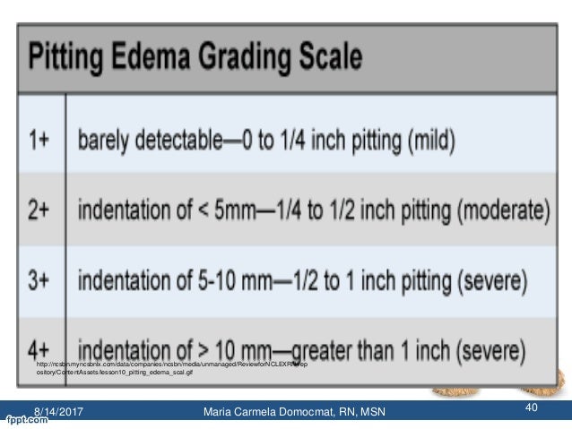 Pitting Edema Scale 1 4 | www.imgkid.com - The Image Kid Has It!