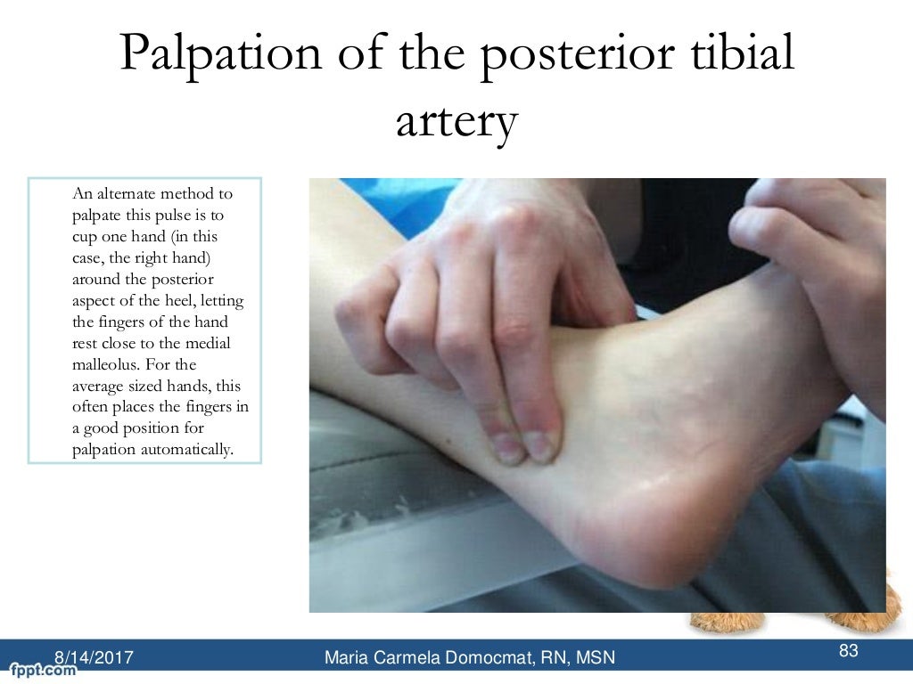 Assessment peripheral blood vessel